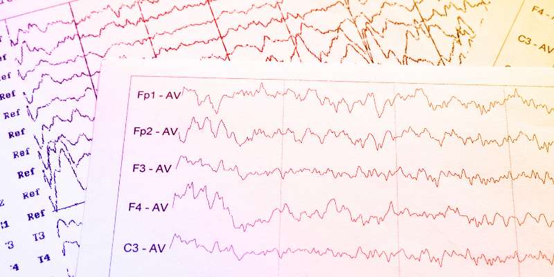 Advanced EEG Data Collection and Storage Solution | EMBIQ